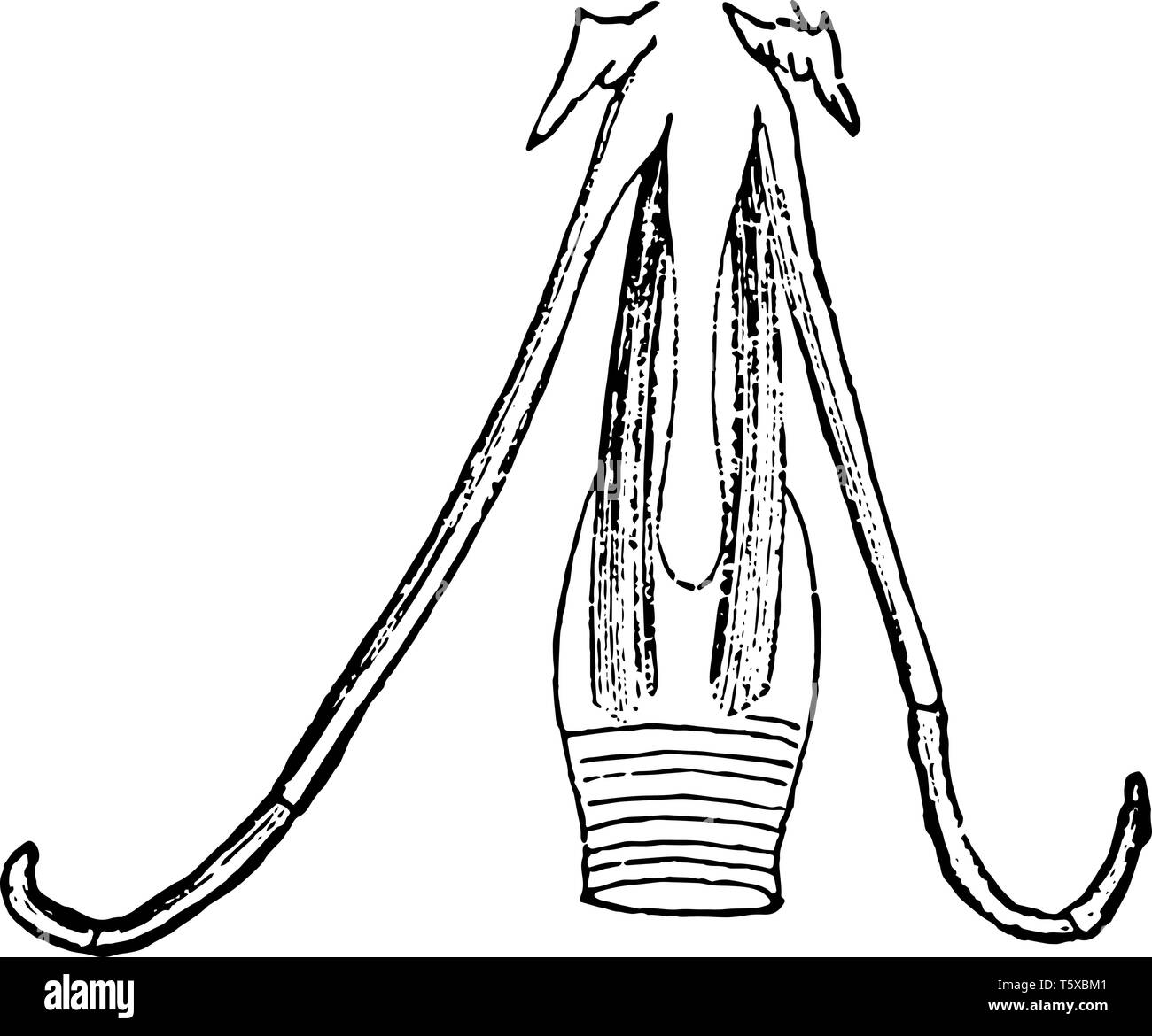 This illustration represents the Larynx Muscles of a Rook vintage line ...
