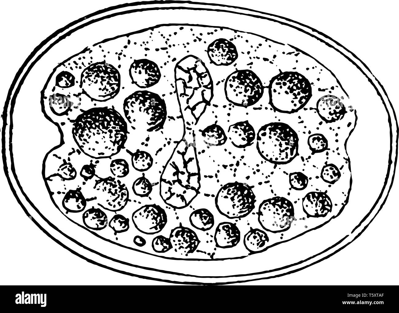 Cyclospora cayetanensis hi-res stock photography and images - Alamy