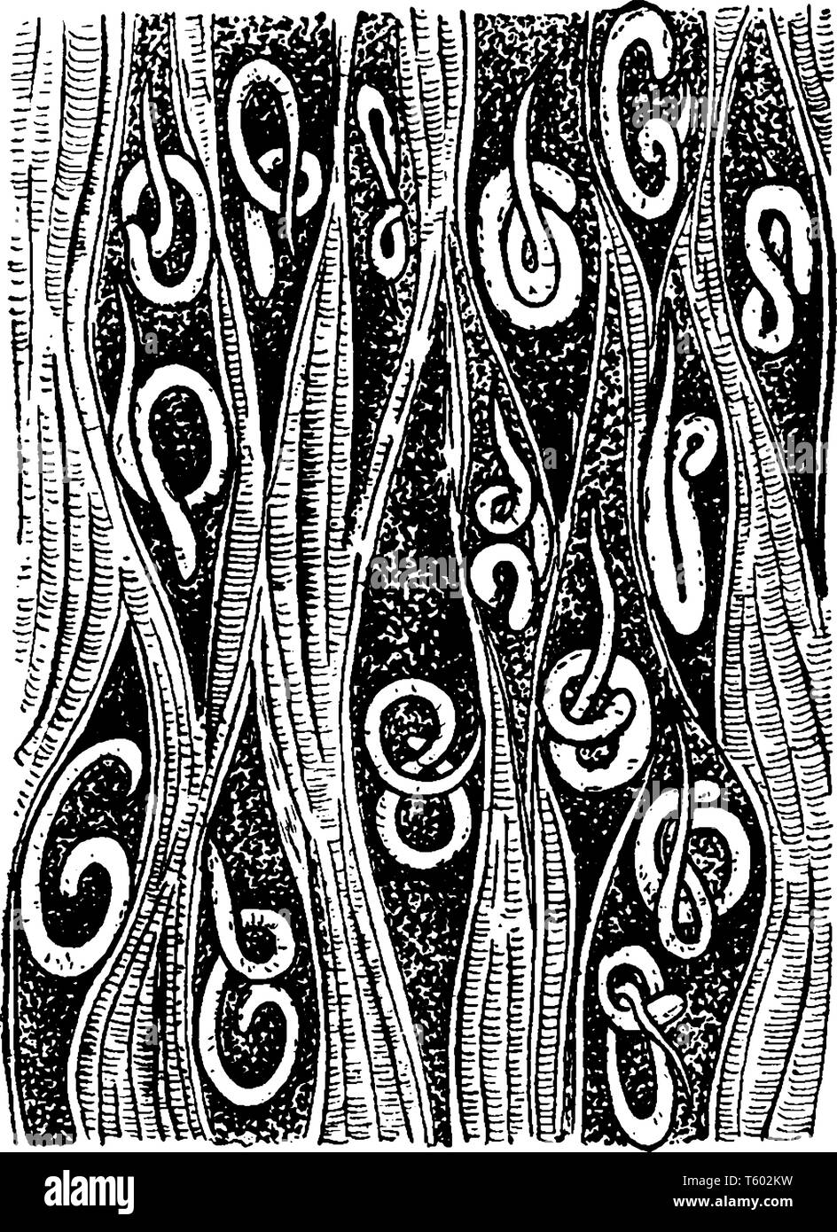 Trichinae is the genus of parasitic roundworms of the phylum Nematoda ...