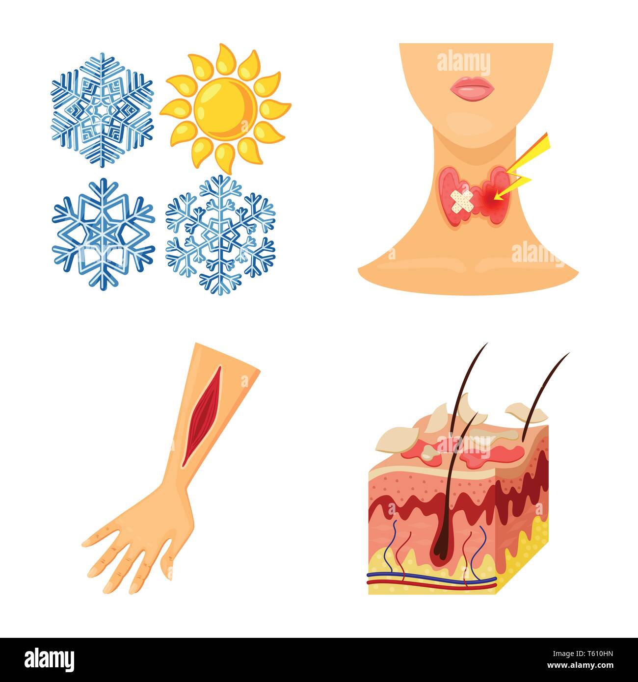 snowflake,endocrine,injury,skin,falling,system,arm,epidermis,ice,neck ...