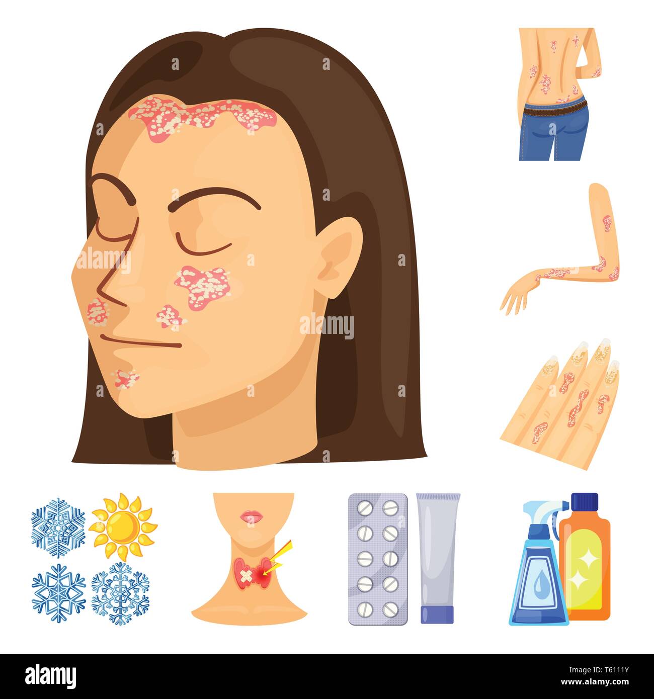 Psoriasis Snowflake Endocrine Pill Chemical Skin Dermatitis Body
