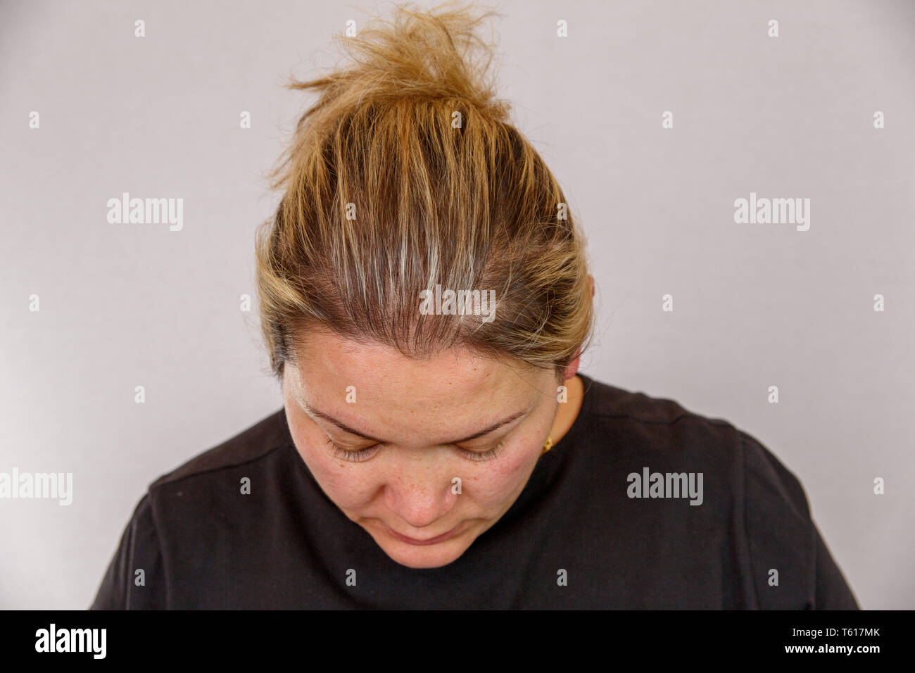 Neckache. Woman Feeling Stress And Strong Neck Pain. Woman Feeling ...