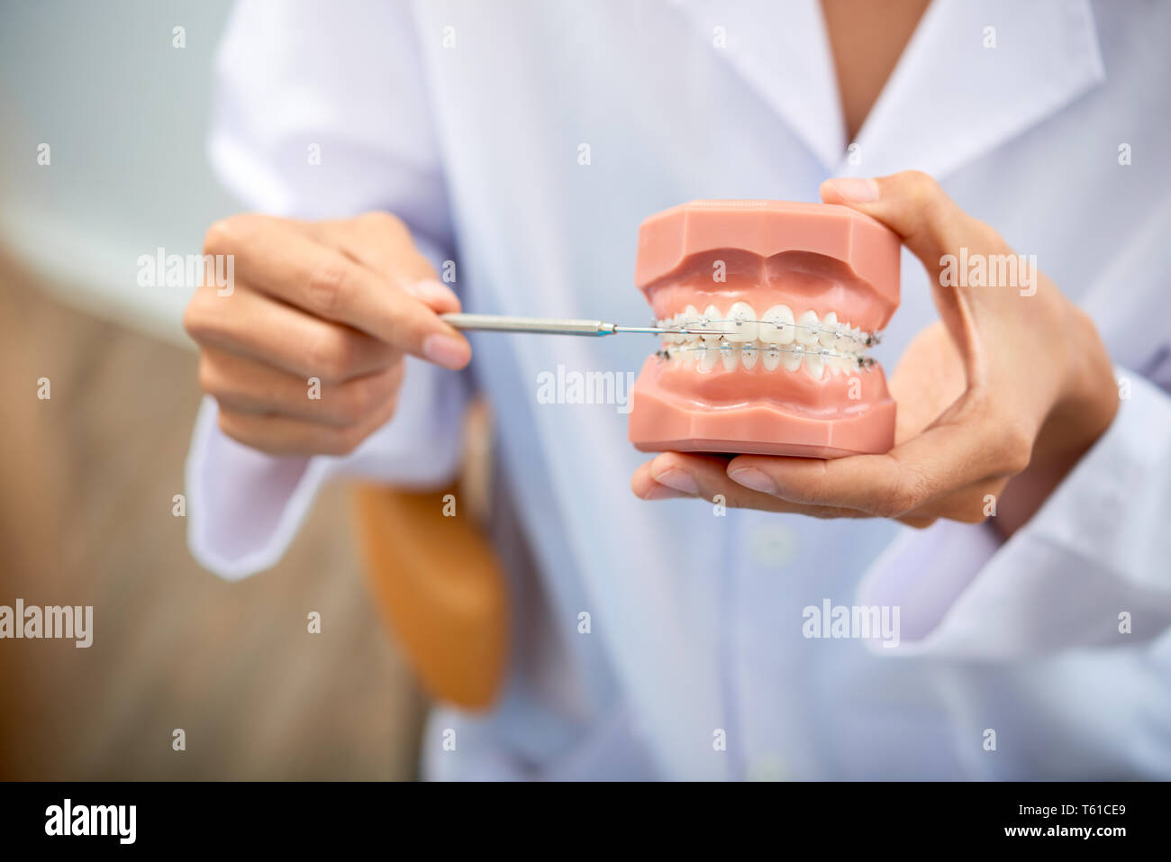Plastic jaws with braces in hands of dentist Stock Photo - Alamy