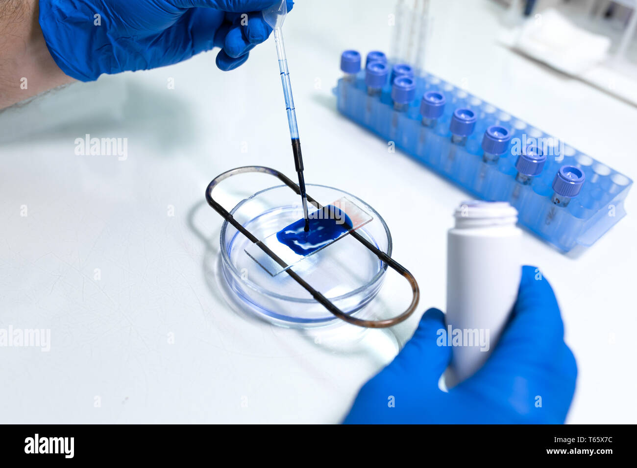 scientist prepare blood sample for research on microscope. Placing ...