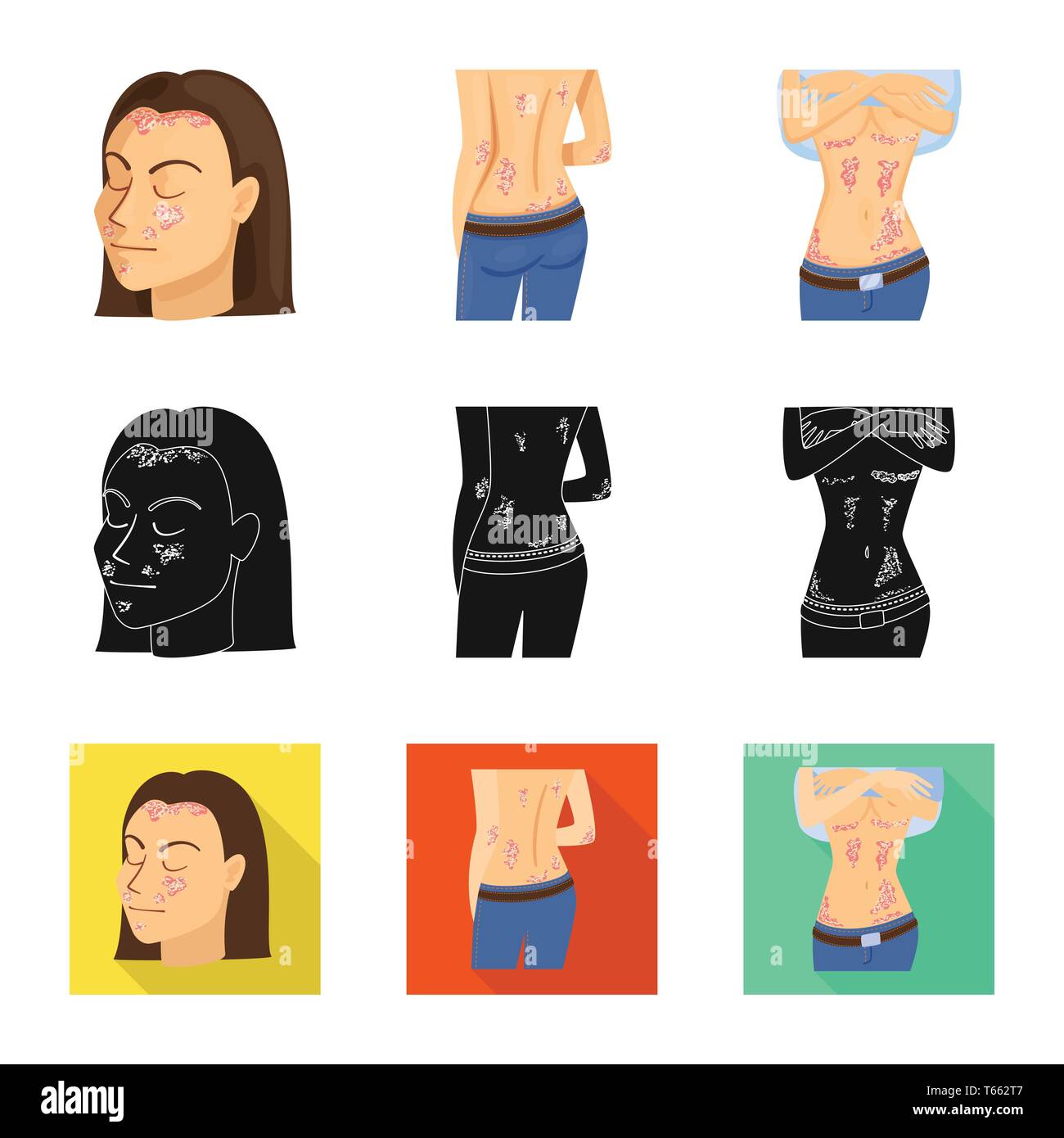 Skin rash back Stock Vector Images - Alamy