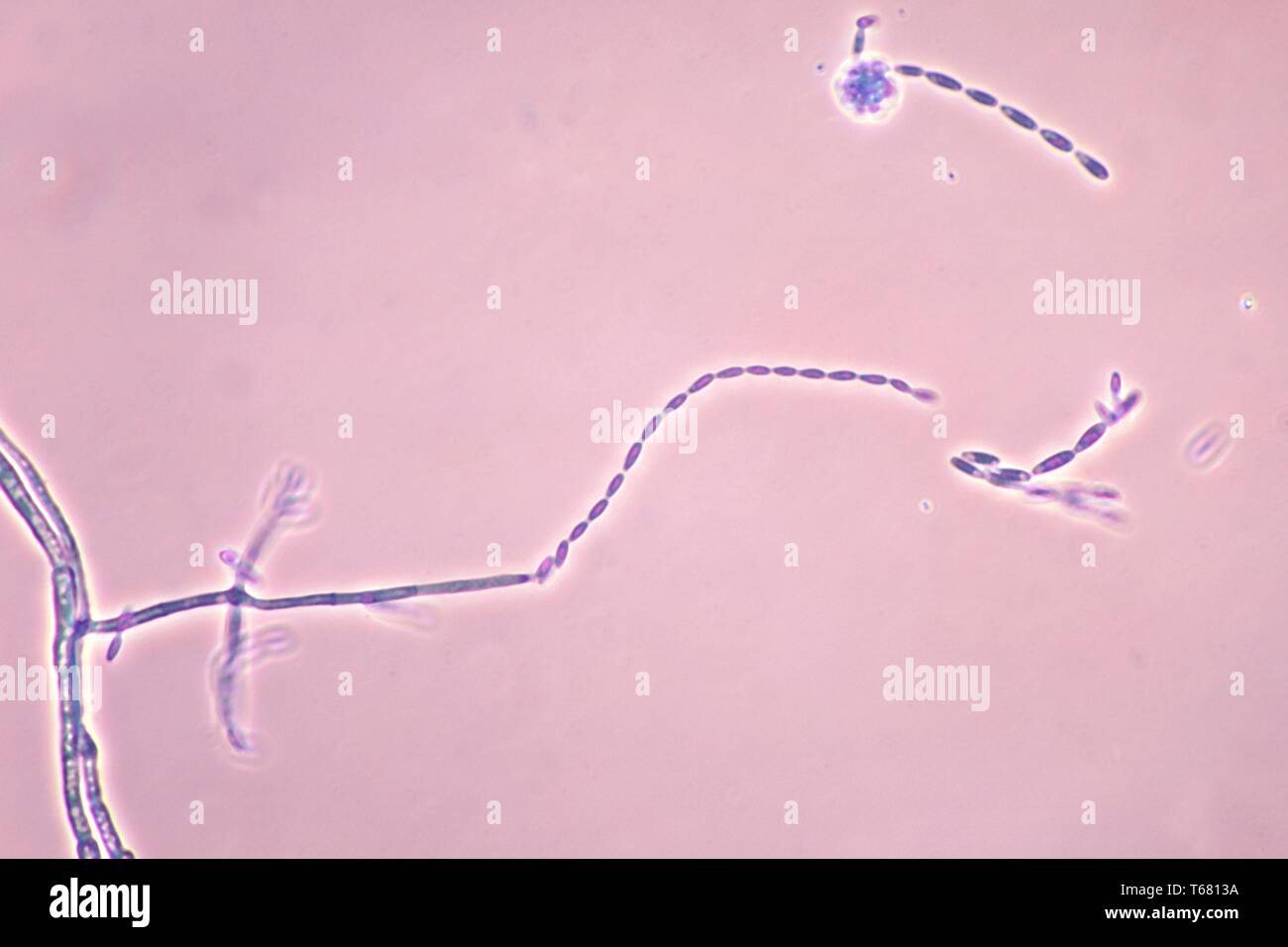 Photomicrograph of the conidiophores and conidia of the fungus Fusarium ...