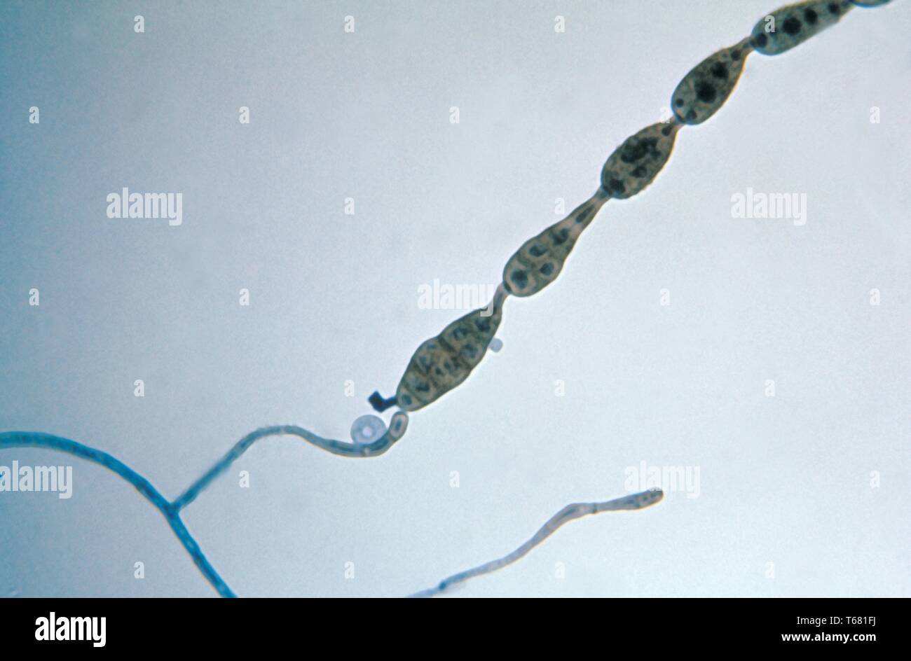 Photomicrograph of a chain of conidia hi-res stock photography and ...