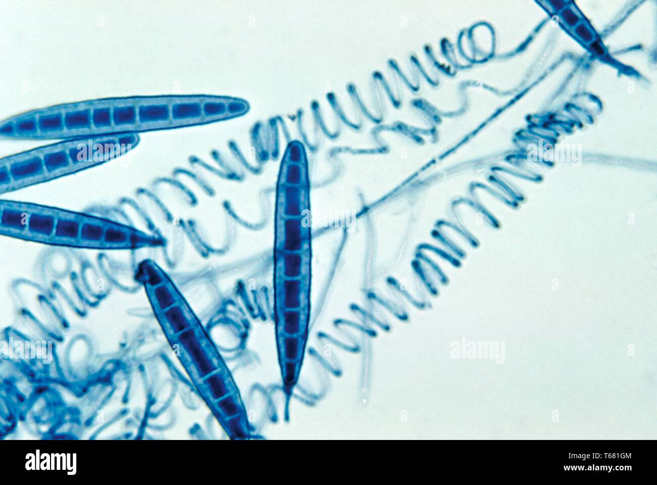 Microsporum Canis Macroconidia