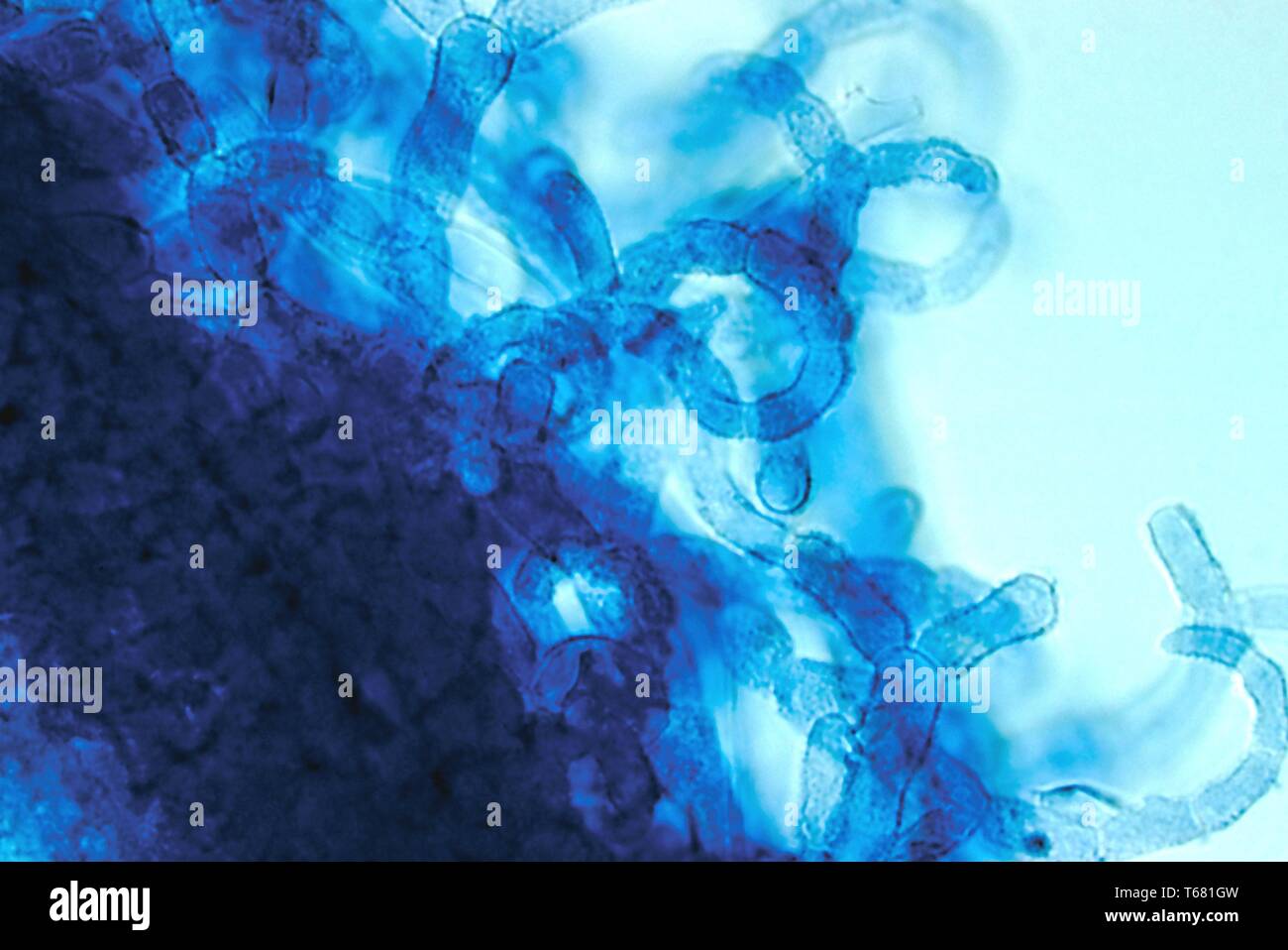 Photomicrograph of the cleistothecium of the fungus arthroderma grubyi ...