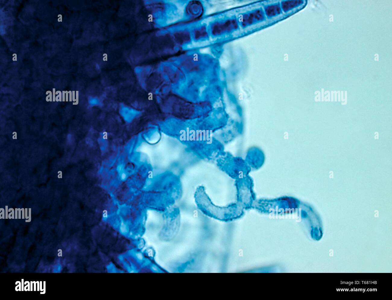 Photomicrograph of the cleistothecium of the fungus Arthroderma grubyi ...