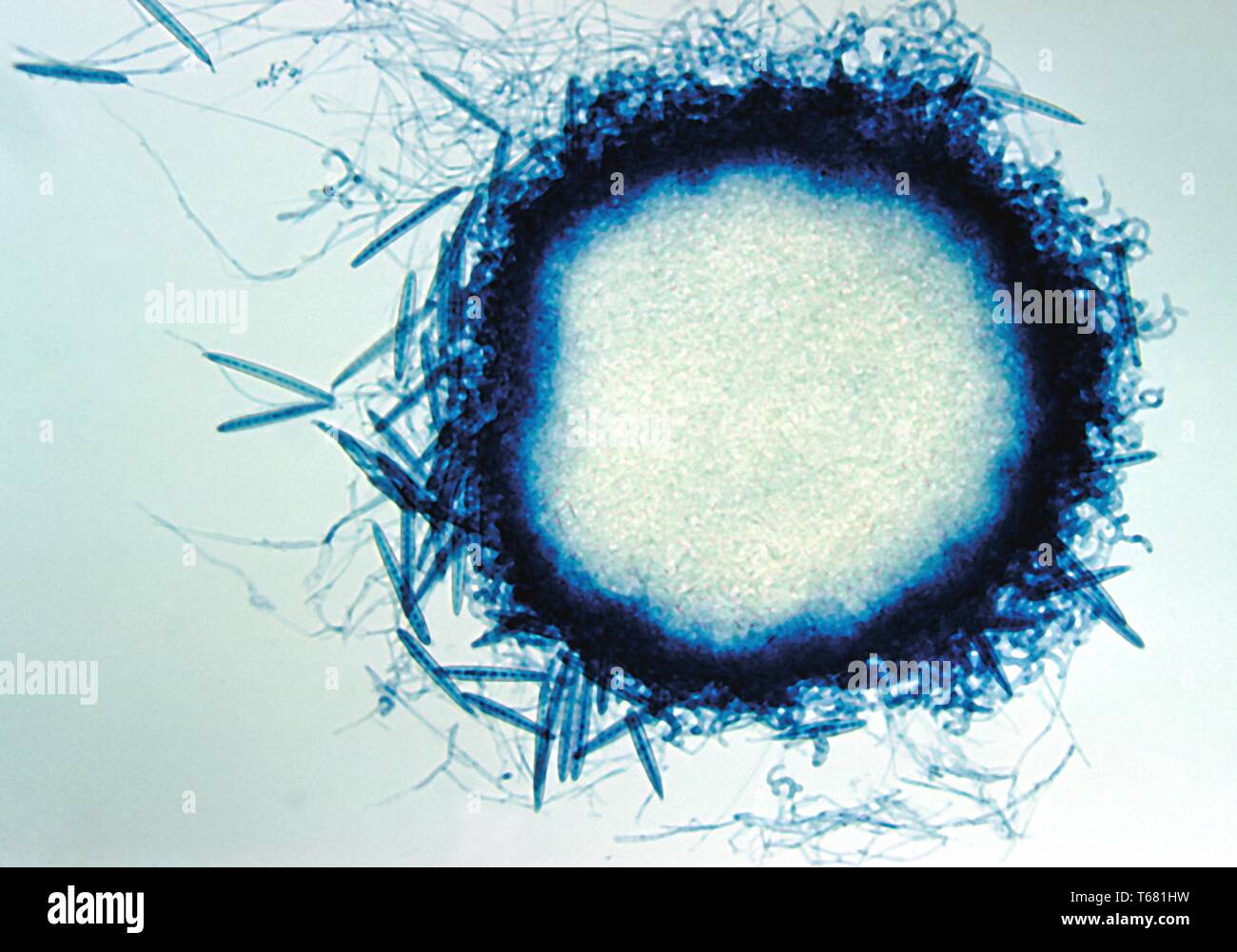Photomicrograph of the mature cleistothecium of the fungus arthroderma ...