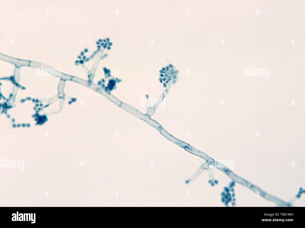 Photomicrograph of the phialides with terminal conidia of the Madurella ...
