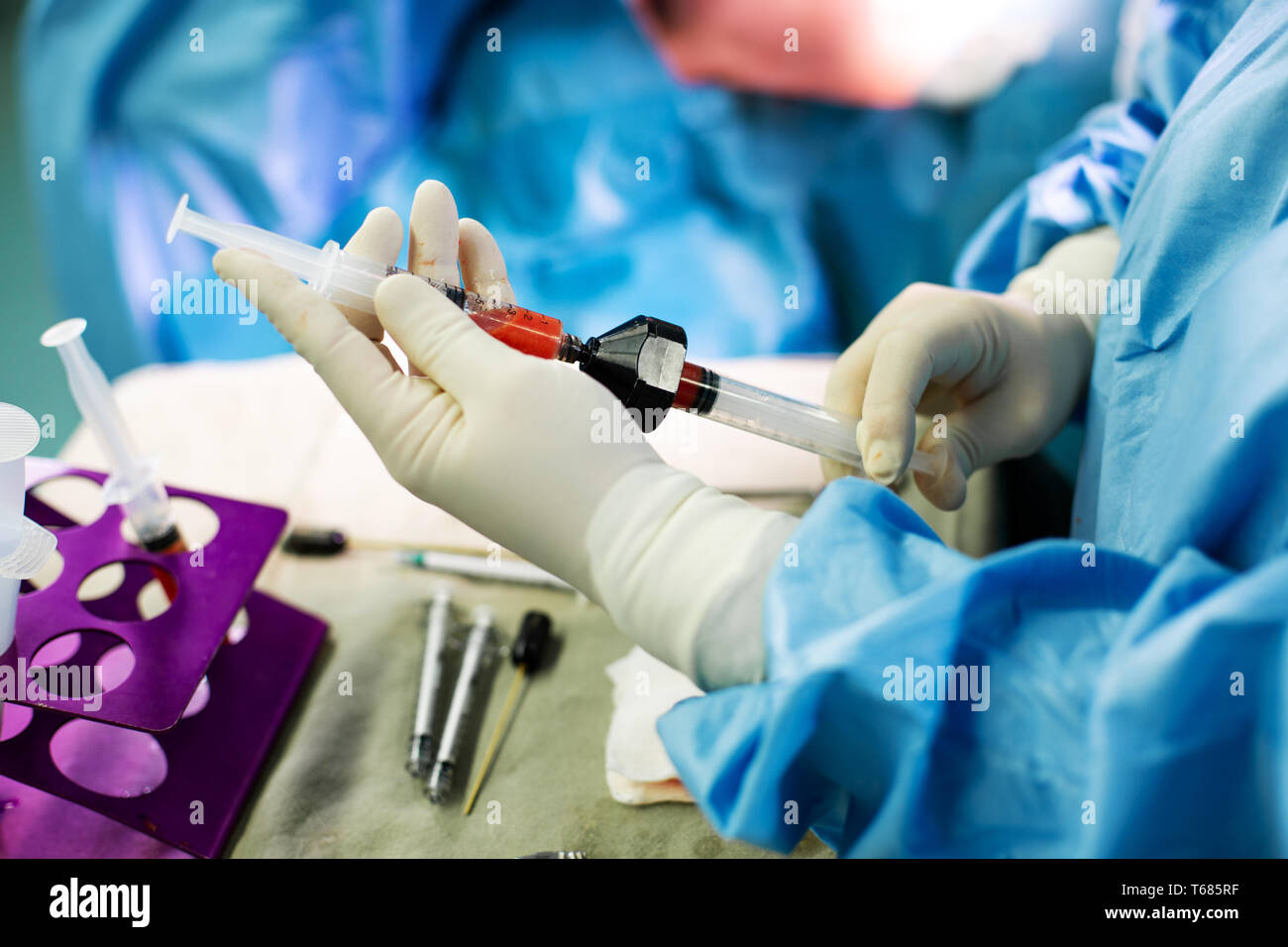 Hands Holding Syringe and Transfer Fat with Nano Fat Transfer Tool in ...