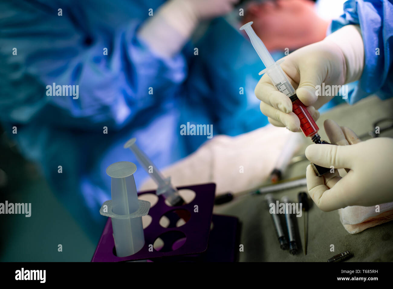 Hands Holding Syringe and Transfer Fat with Nano Fat Transfer Tool in ...