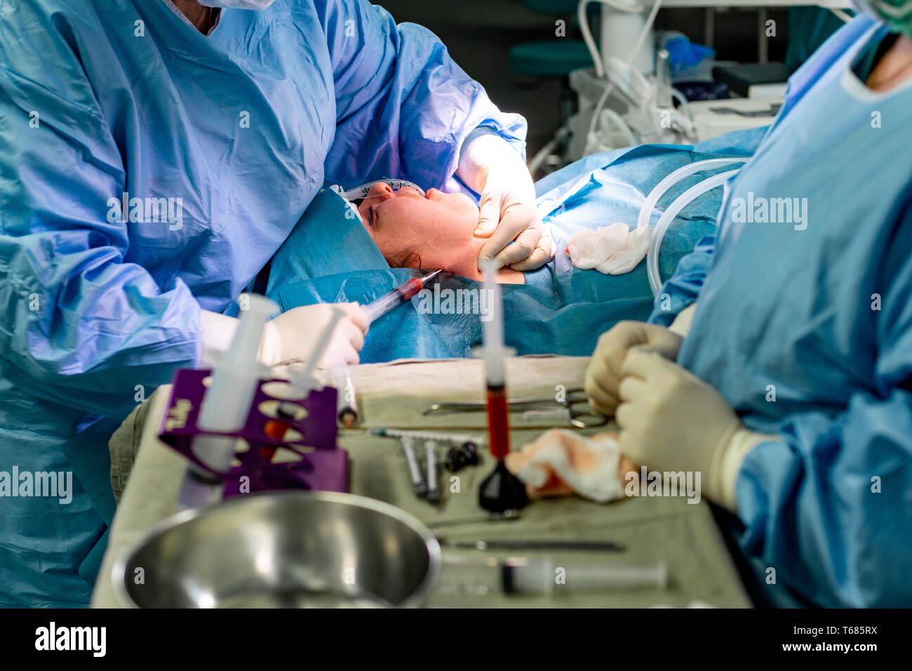 Hands Holding Syringe and Transfer Fat with Nano Fat Transfer Tool in ...