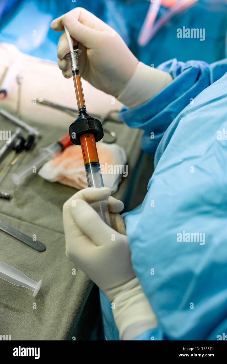 Hands Holding Syringe and Transfer Fat with Nano Fat Transfer Tool in ...