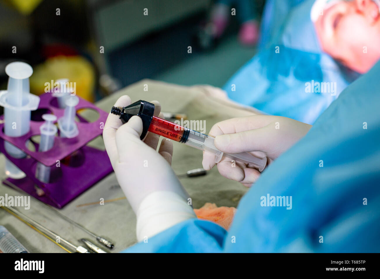 Hands Holding Syringe and Transfer Fat with Nano Fat Transfer Tool in ...