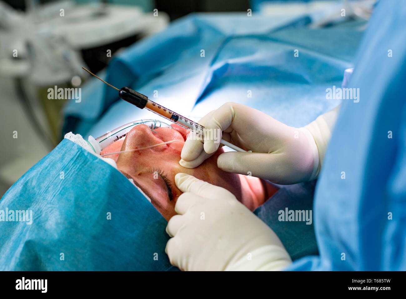 Hands Holding Syringe and Transfer Fat with Nano Fat Transfer Tool in ...