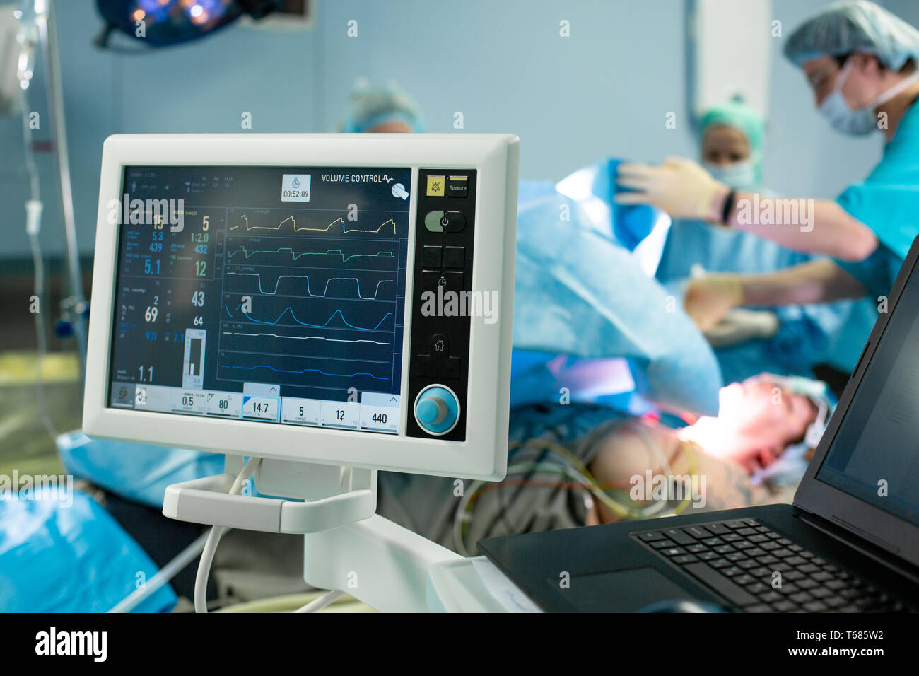 Electrocardiogram in hospital surgery operating emergency room showing ...
