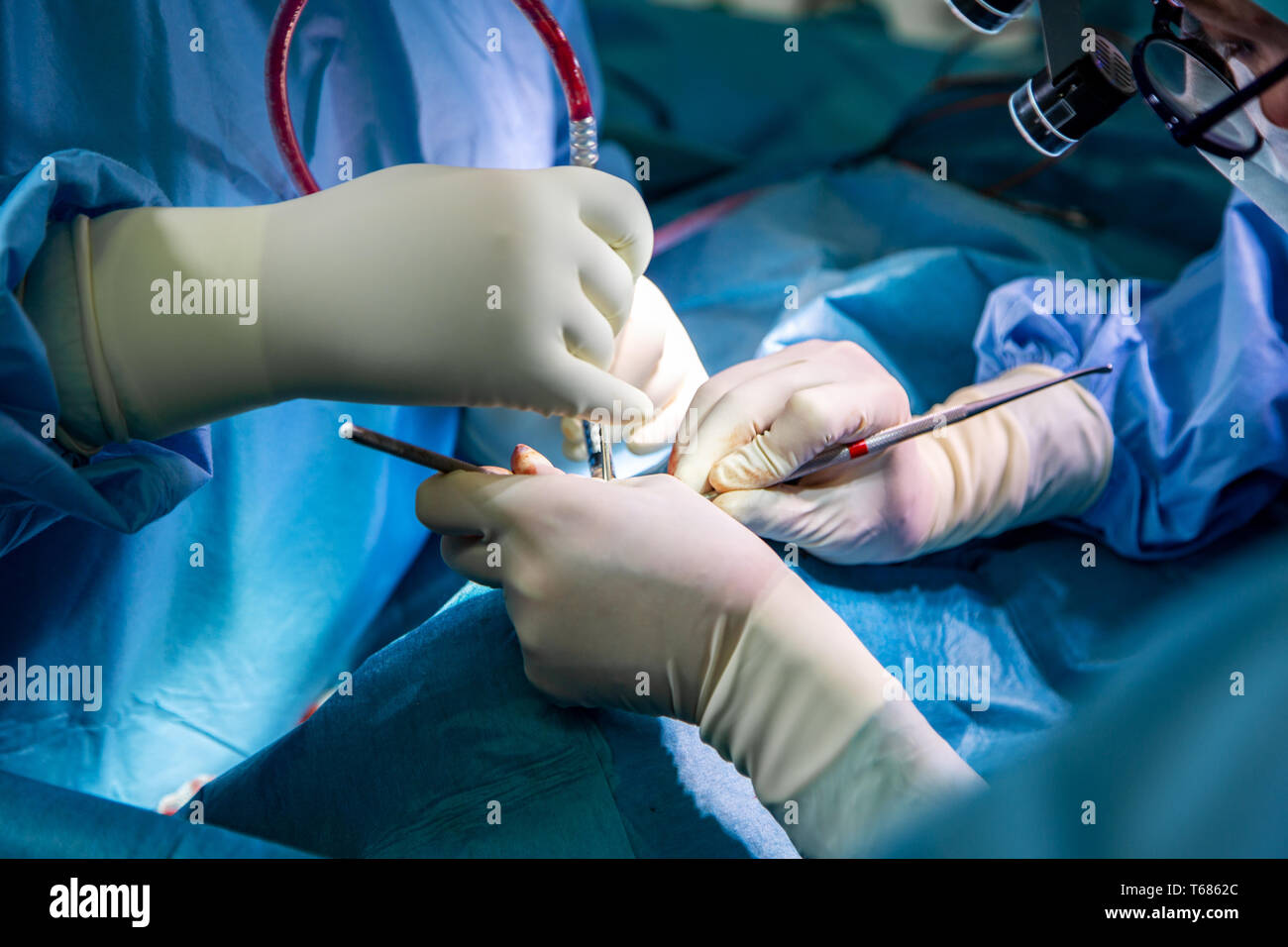Surgeon and his assistant performing cosmetic surgery on nose in ...