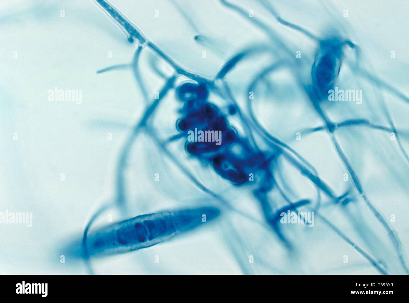Photomicrograph of the cleistothecium of the fungus arthroderma grubyi ...