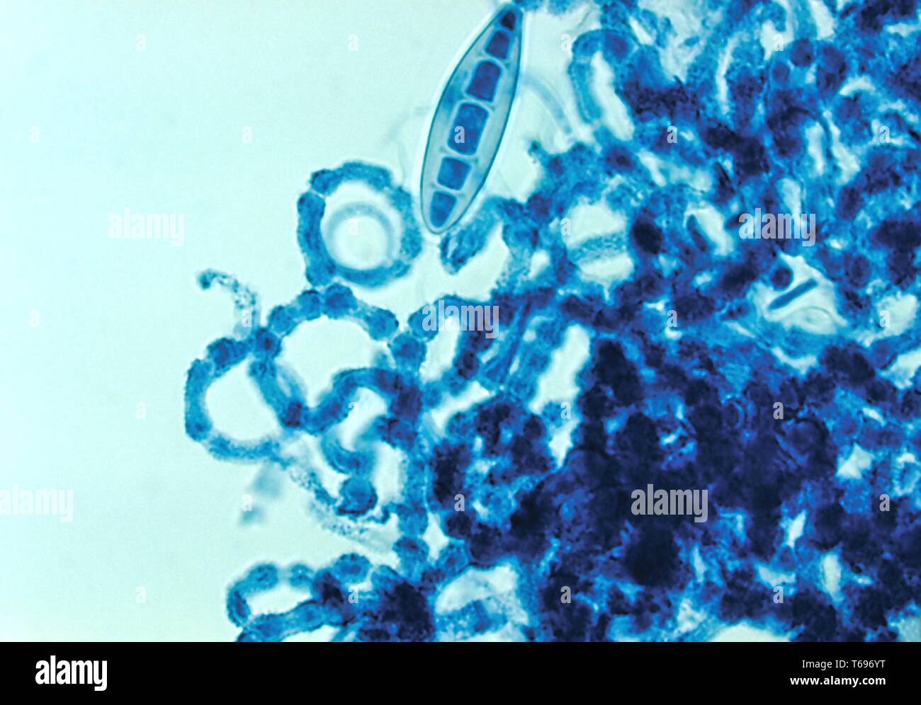 Trichophyton ajelloi fungus hi-res stock photography and images - Alamy