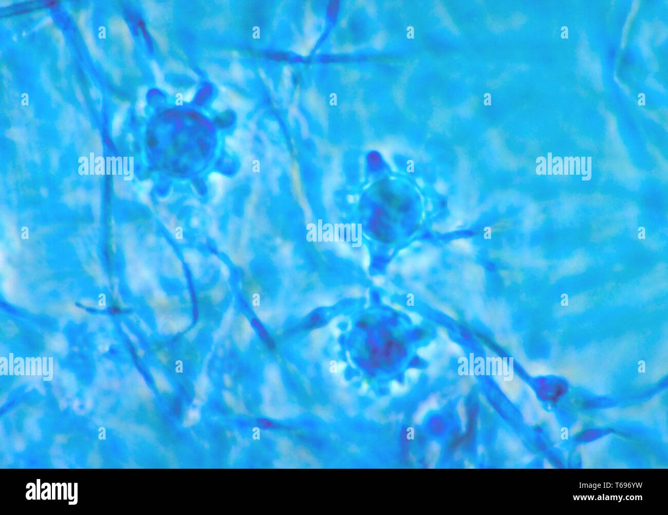 Photomicrograph of the multiple macroconidia of the fungus Histoplasma ...