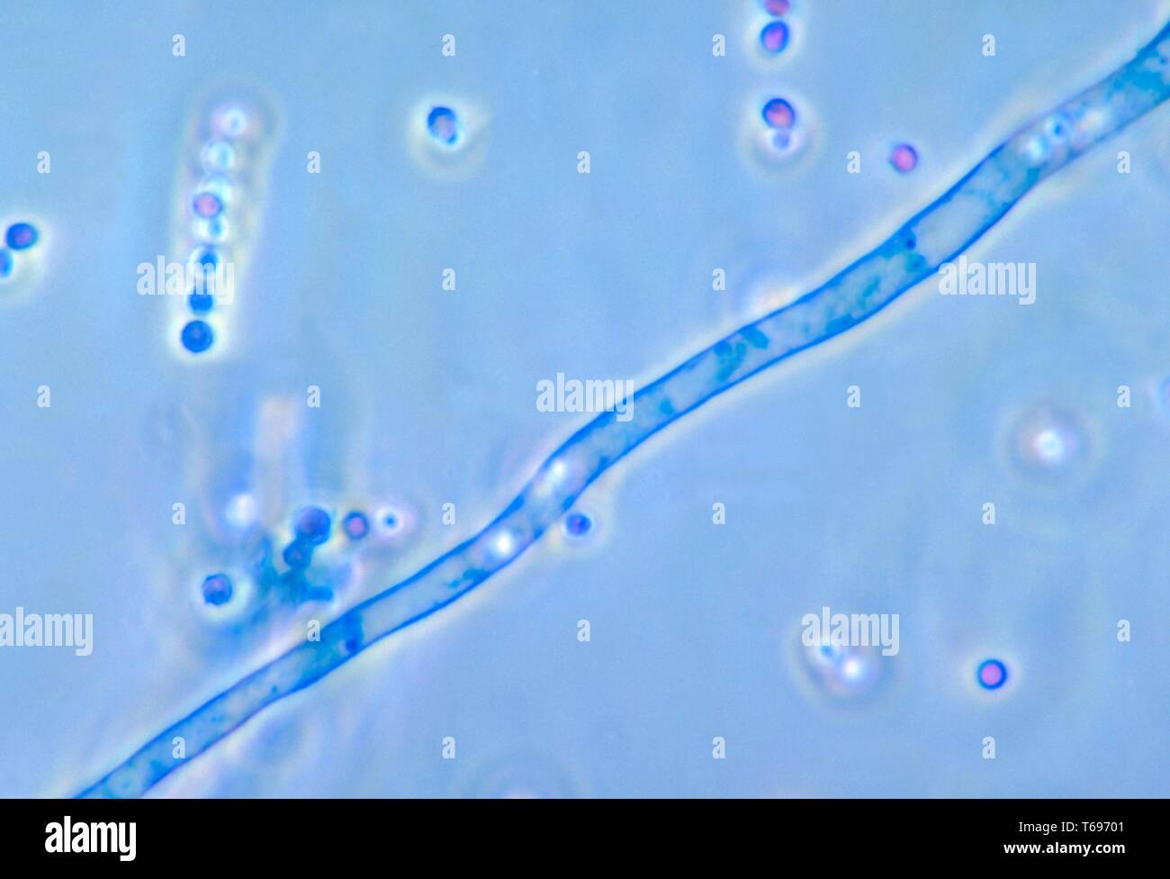 Photomicrograph of the conidiophore filament of the fungus aspergillus ...
