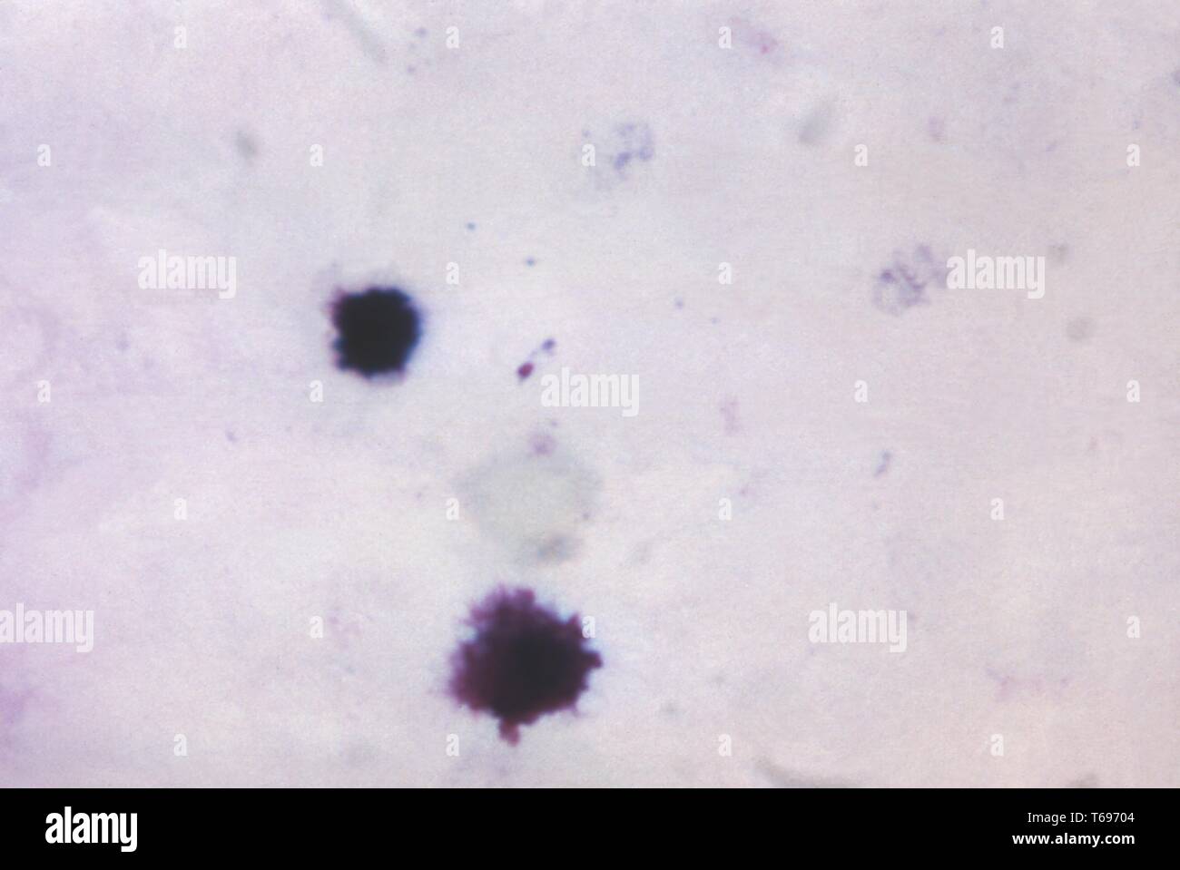 Ameboid hi-res stock photography and images - Alamy