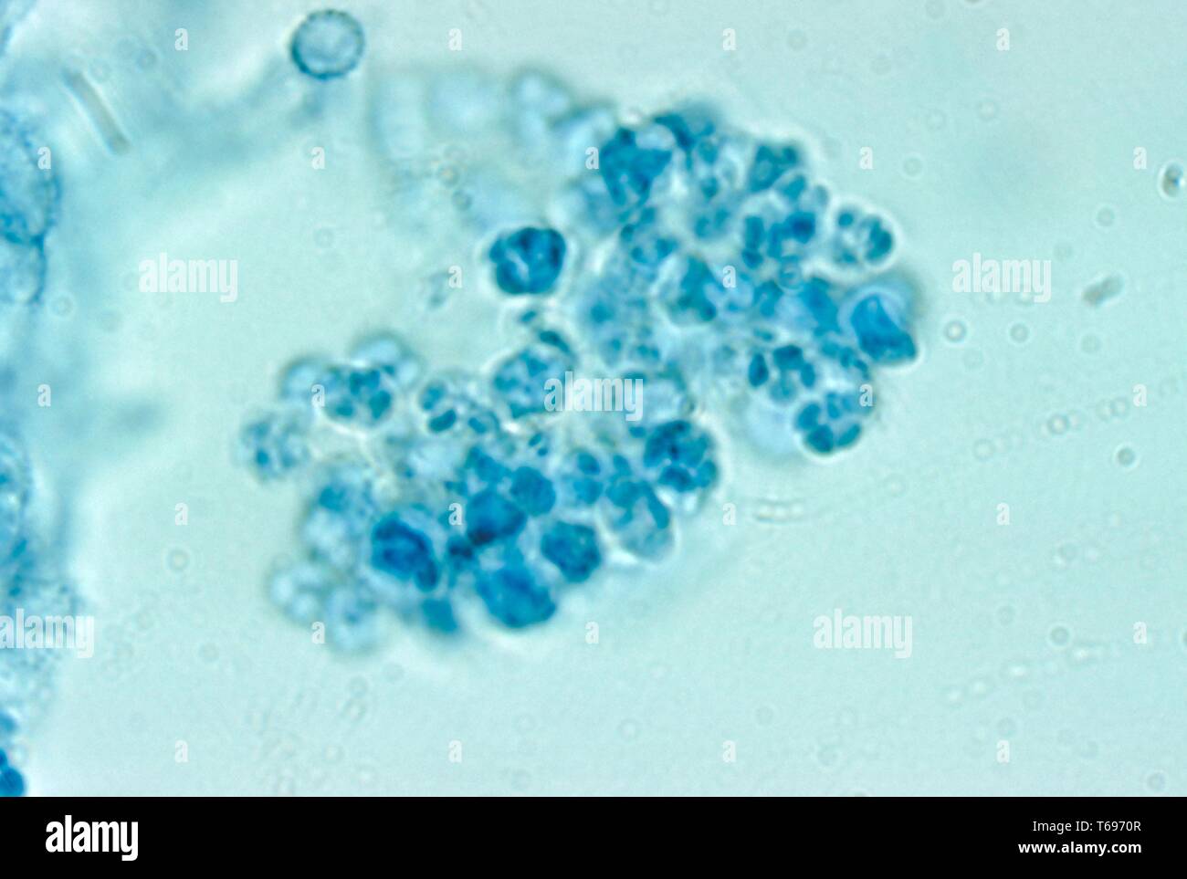 Photomicrograph of the asci and ascospores of the fungus Arthroderma ...