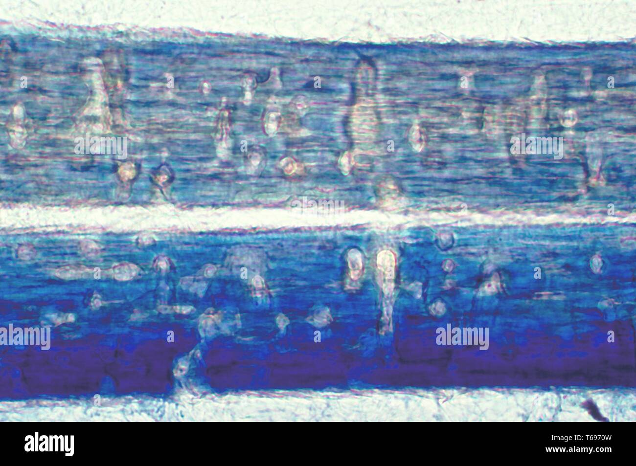 Trichophyton mentagrophytes hi-res stock photography and images - Alamy