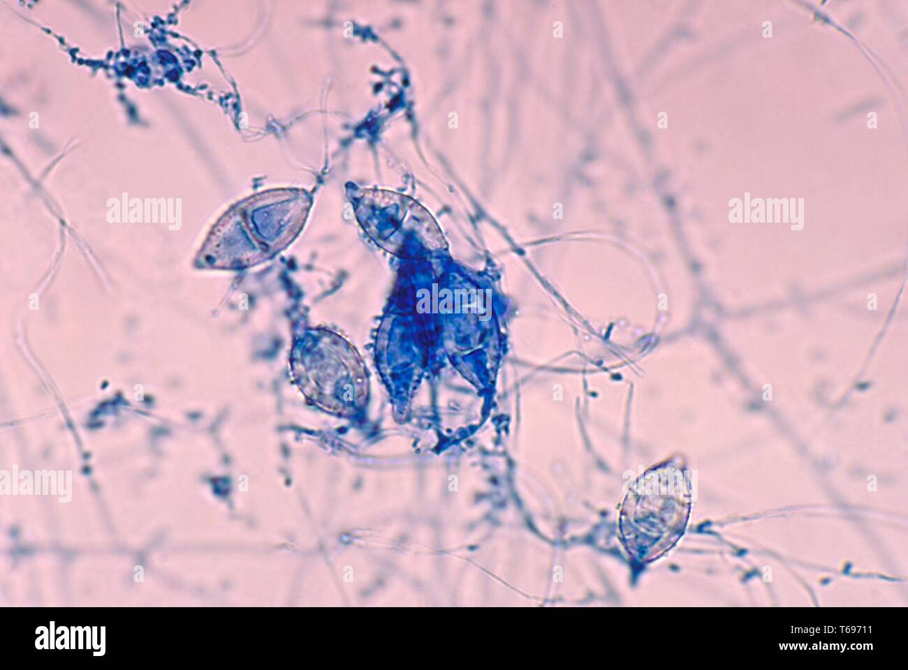 Microsporum fungus hi-res stock photography and images - Alamy