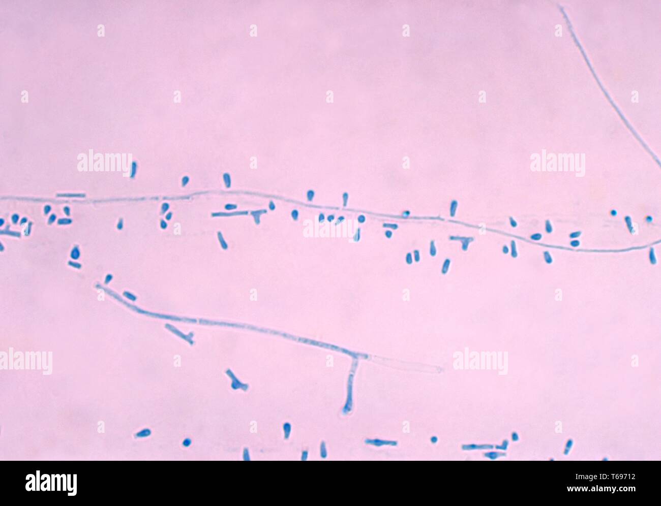 Microconidia hi-res stock photography and images - Alamy