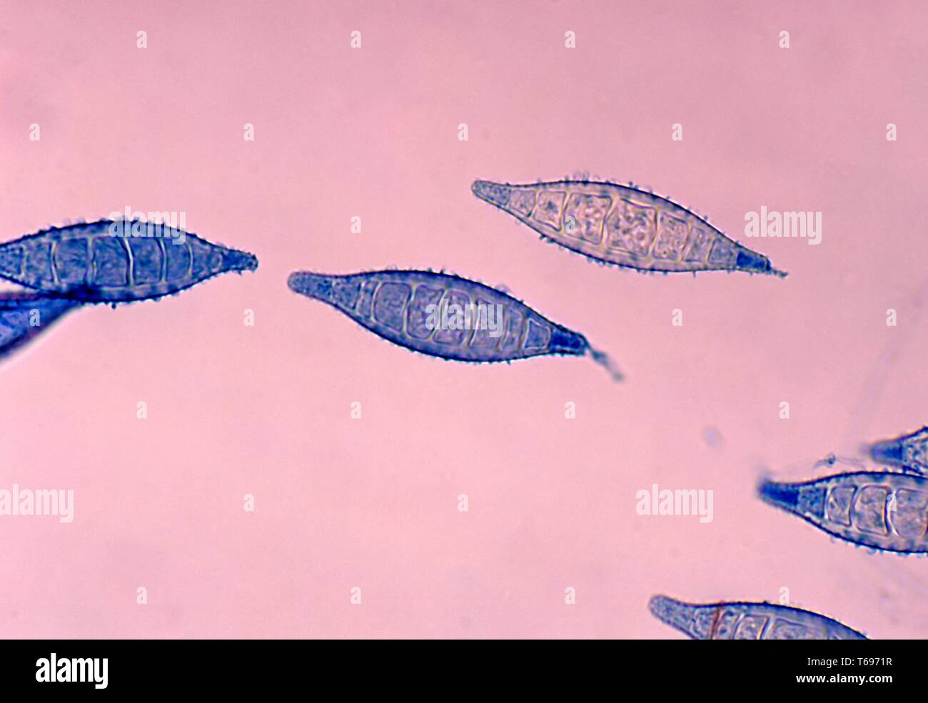 Microsporum canis hi-res stock photography and images - Alamy