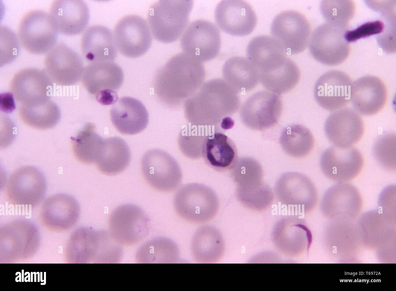 Trophozoite hi-res stock photography and images - Alamy