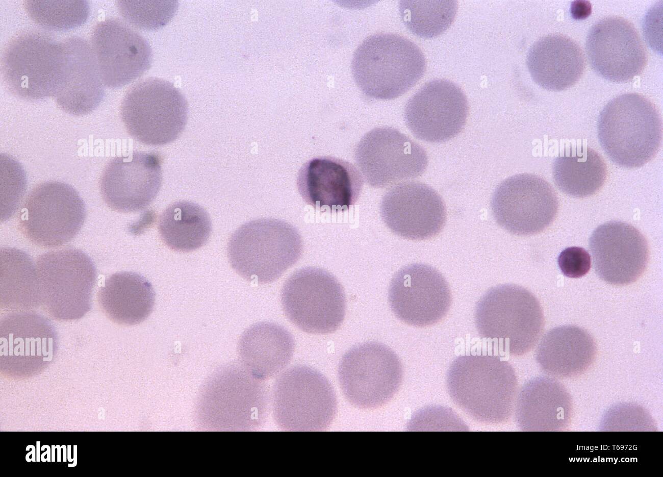 Thin film photomicrograph of an immature plasmodium malariae schizont ...