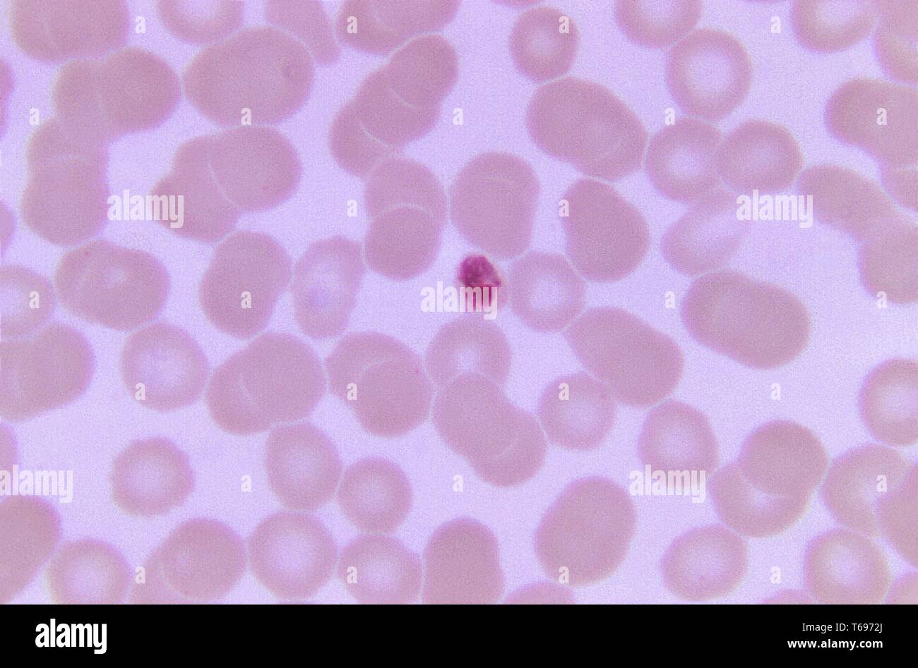 Giemsa stain photomicrograph of a plasmodium malariae trophozoite hi ...