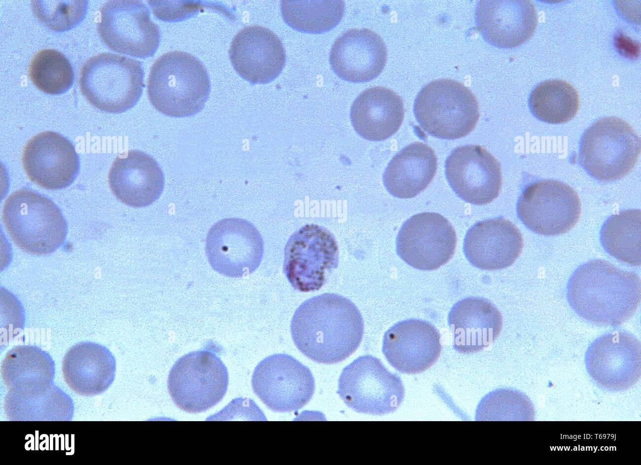 Plasmodium micrograph hi-res stock photography and images - Alamy