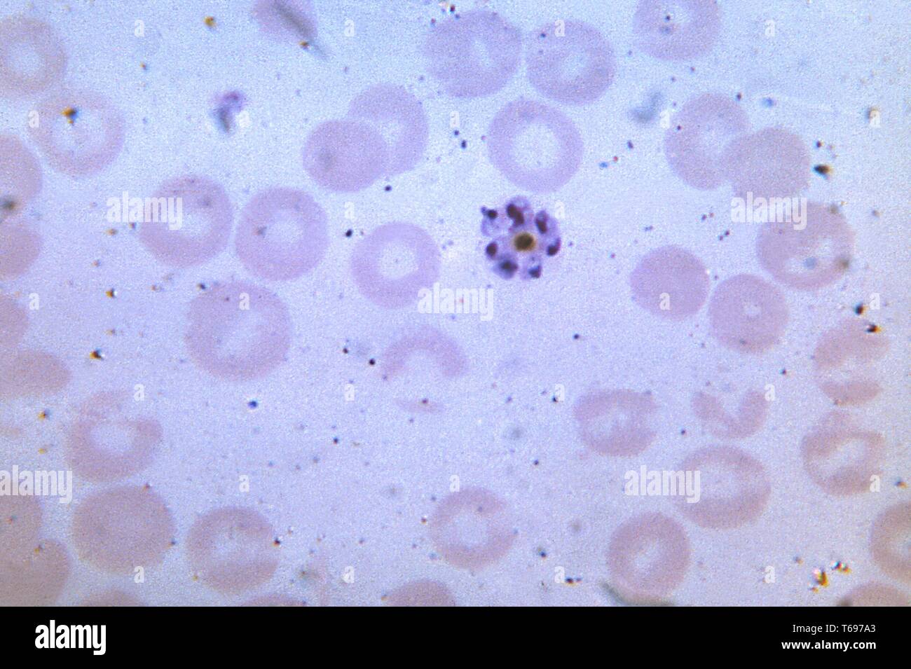 Plasmodium Malariae Sporozoites