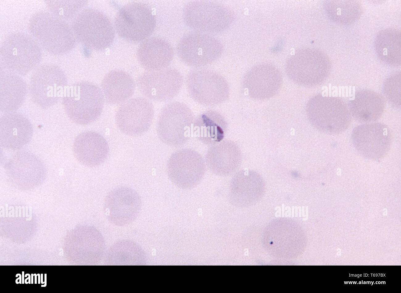 Trophozoite hi-res stock photography and images - Alamy