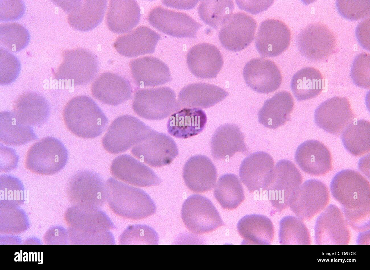 Thin film photomicrograph of a Plasmodium malariae macrogametocyte ...