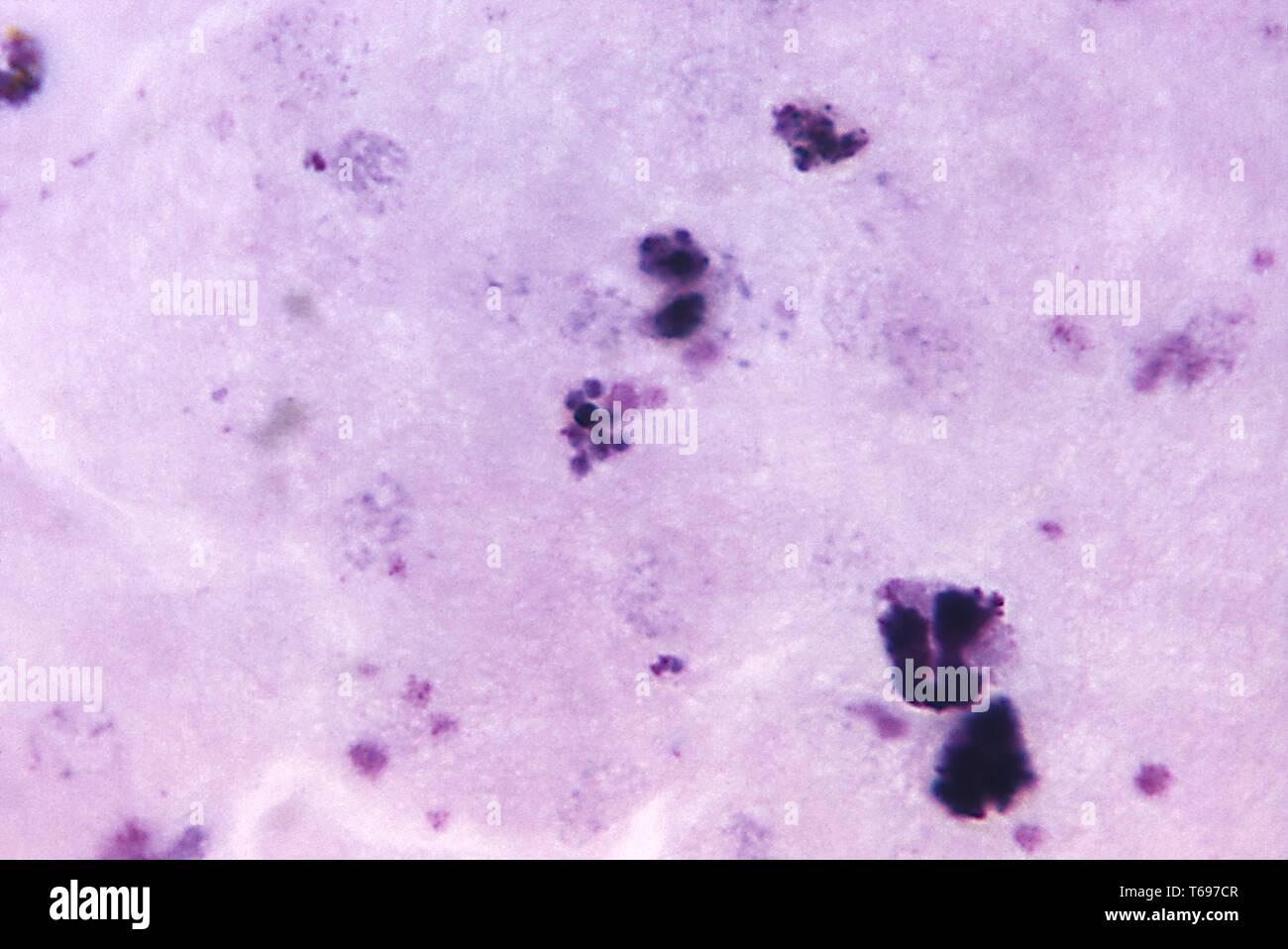 Giemsa stain thin film photomicrograph of a mature Plasmodium malariae ...