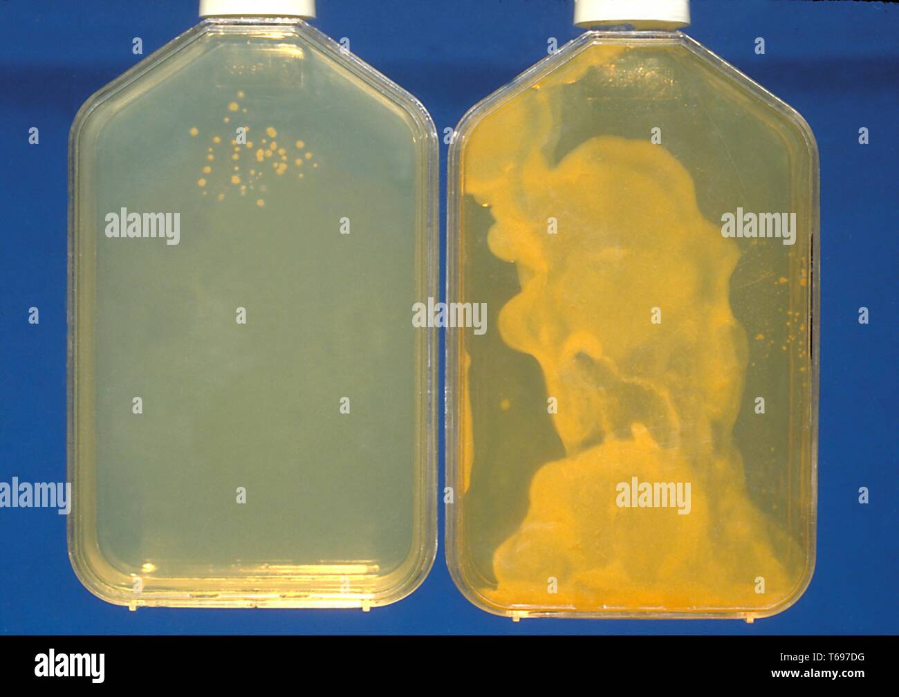 Histoplasma capsulatum specimen cultures hi-res stock photography and ...