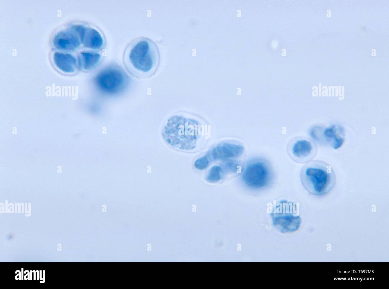 Photomicrograph of the achlorophyllic algae prototheca wickerhamii hi ...
