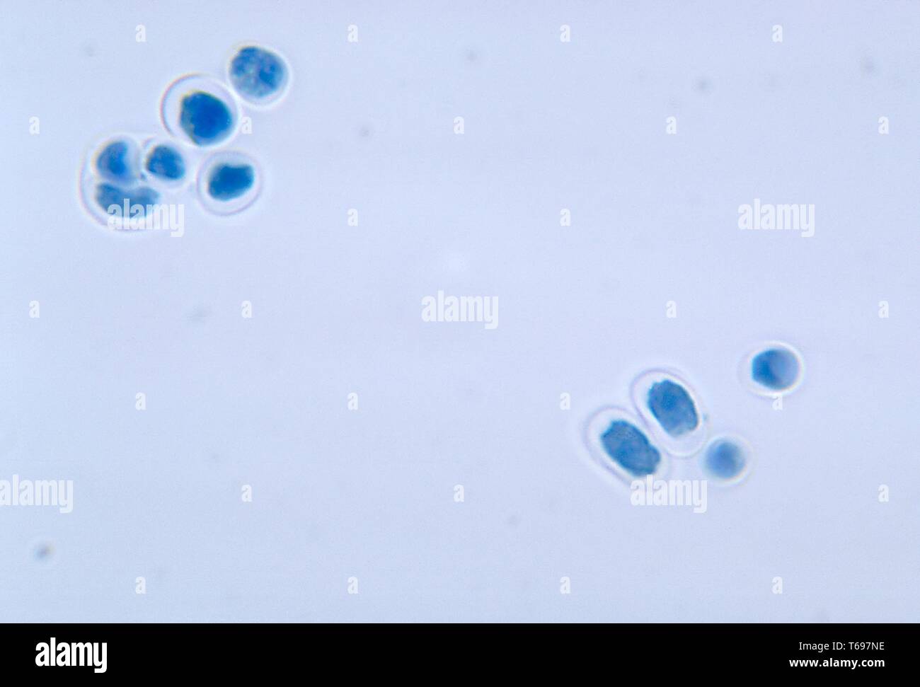Photomicrograph of the achlorophyllic algae prototheca moriformis hi ...