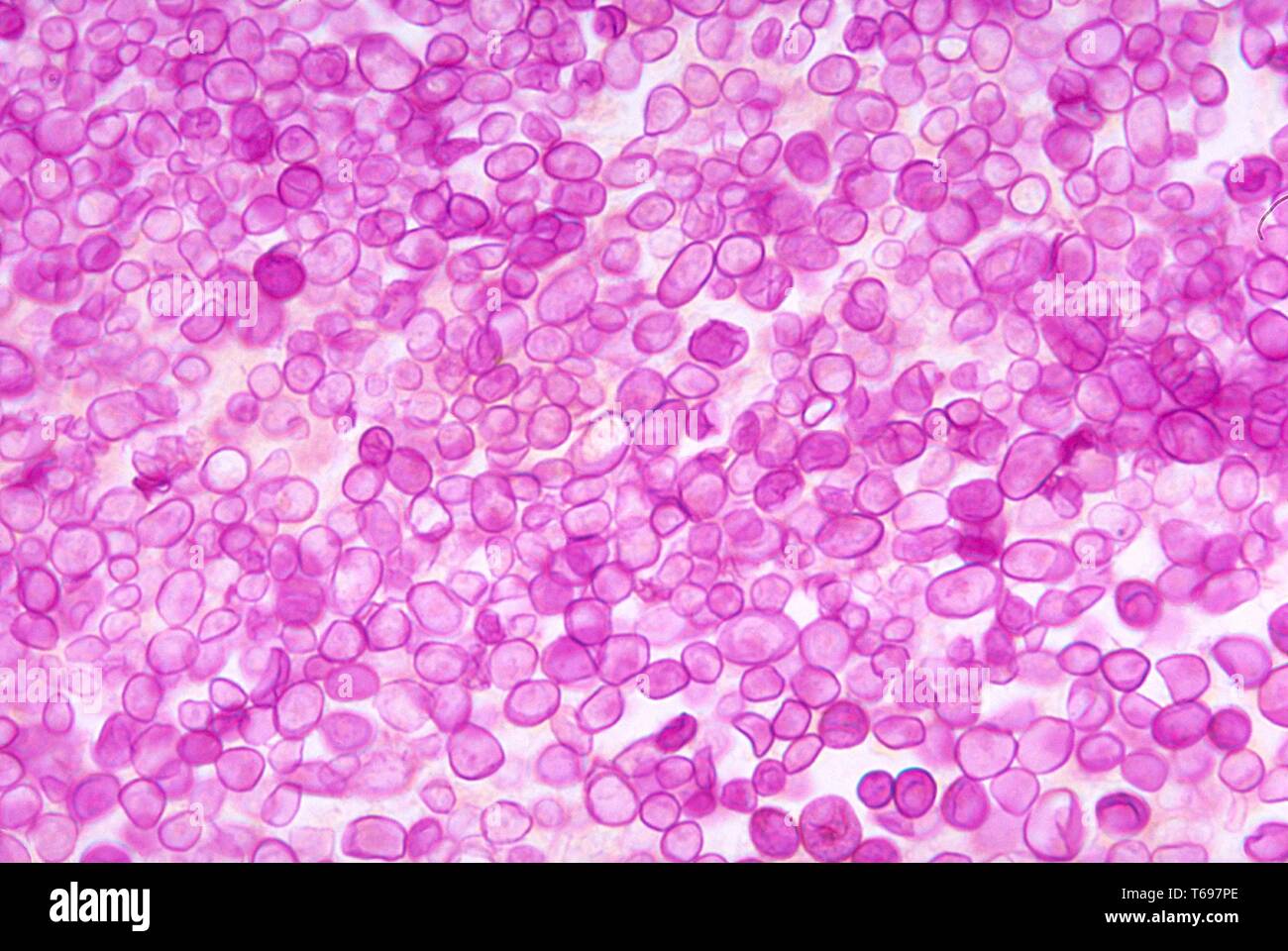 Photomicrograph of the histopathology associated with protothecosis in ...