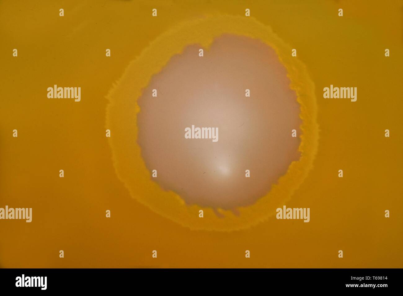 Actinomyces hi-res stock photography and images - Alamy