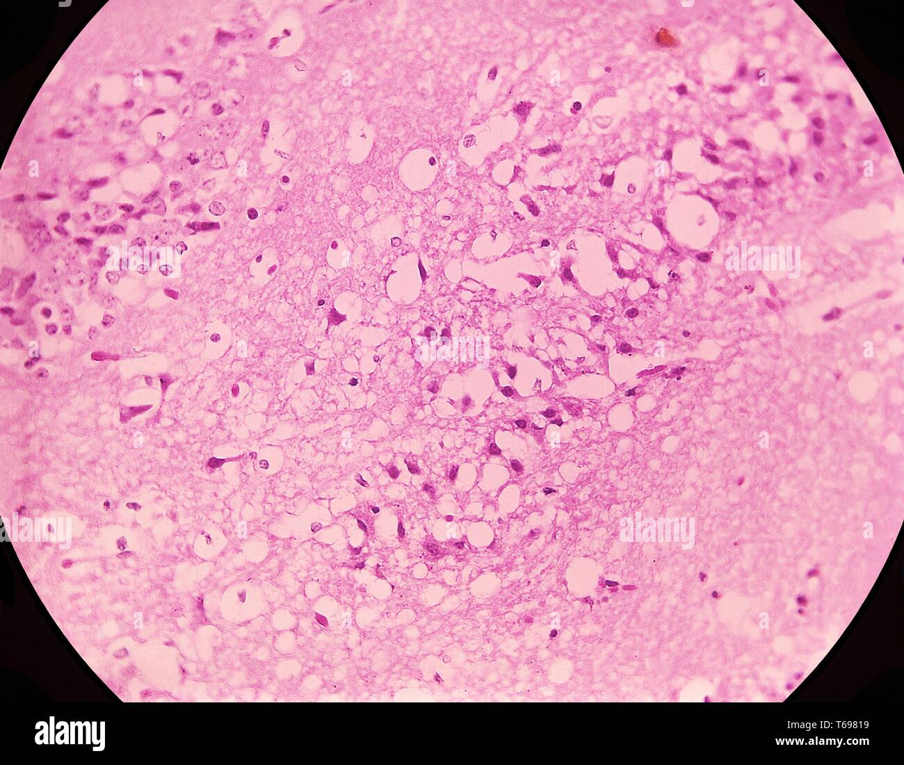 Nervous tissue mouse hi-res stock photography and images - Alamy
