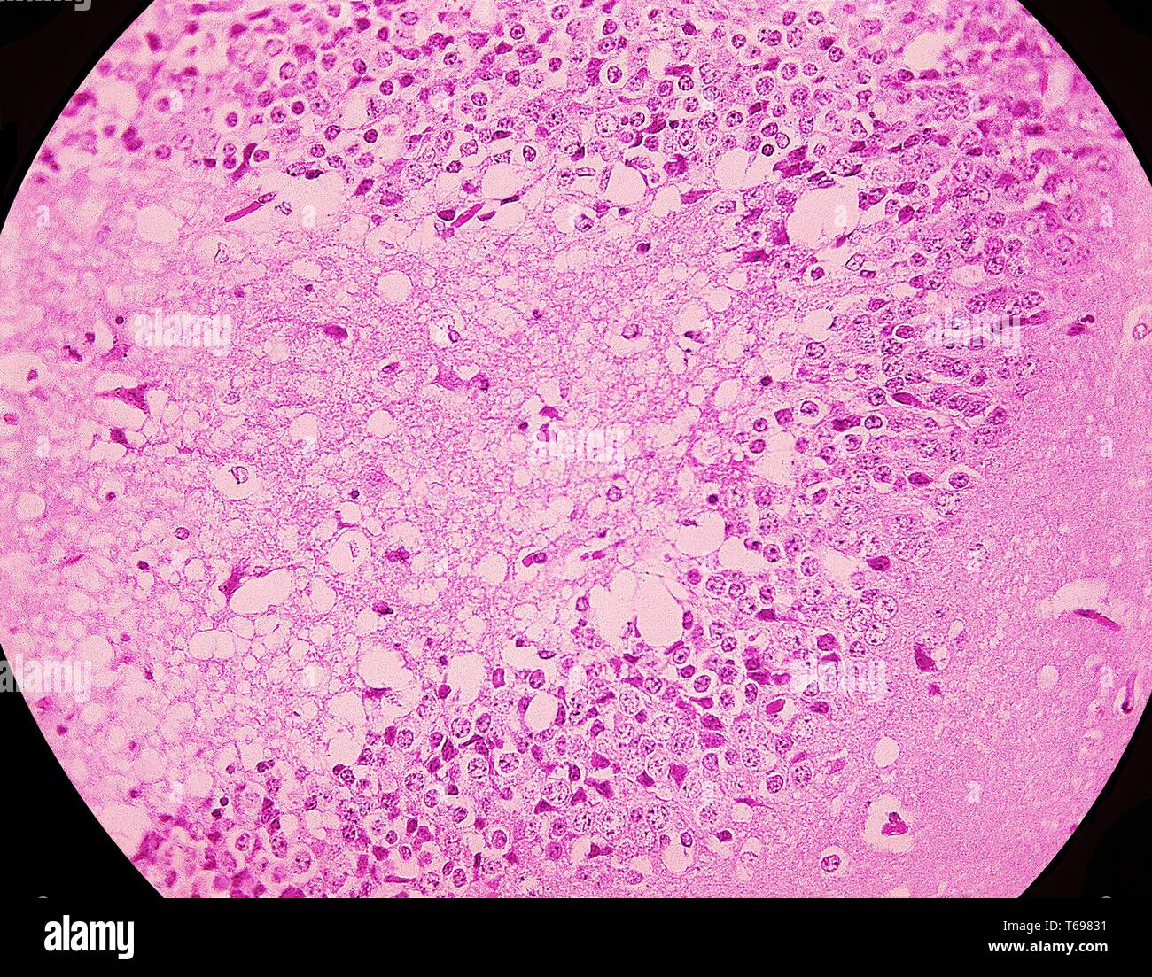 Nervous tissue mouse hi-res stock photography and images - Alamy