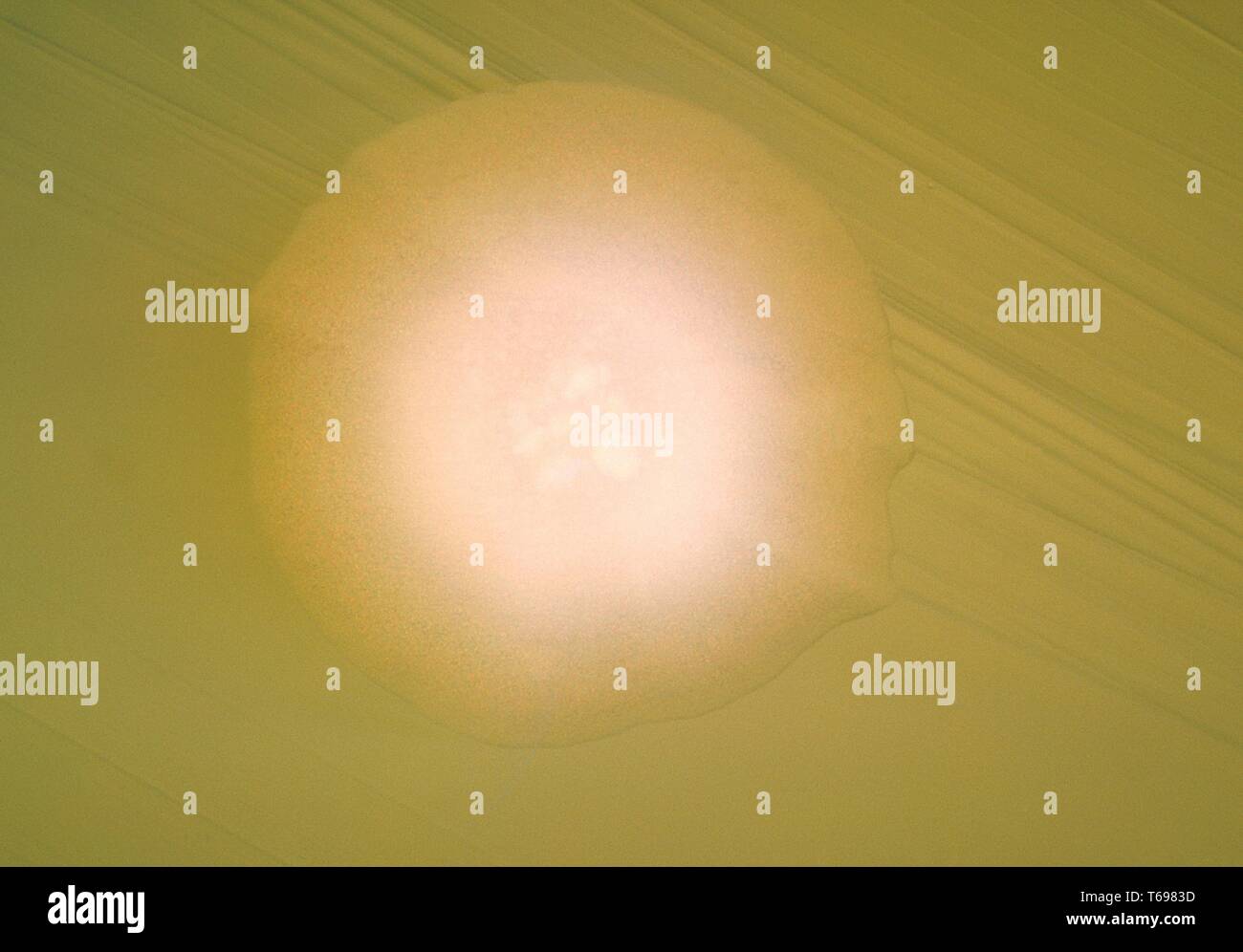 Actinomyces hi-res stock photography and images - Alamy